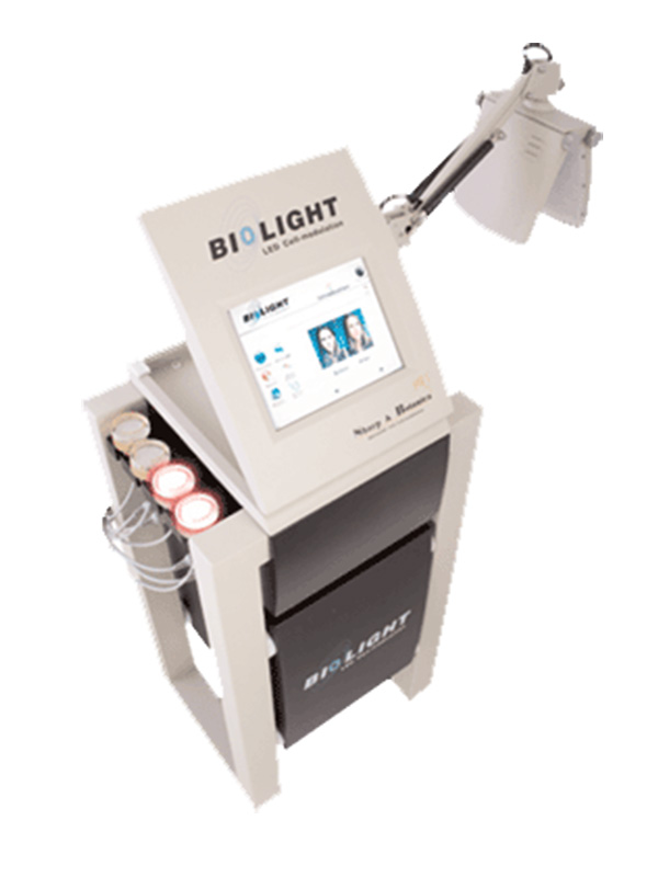 Simmer Engineering Limited